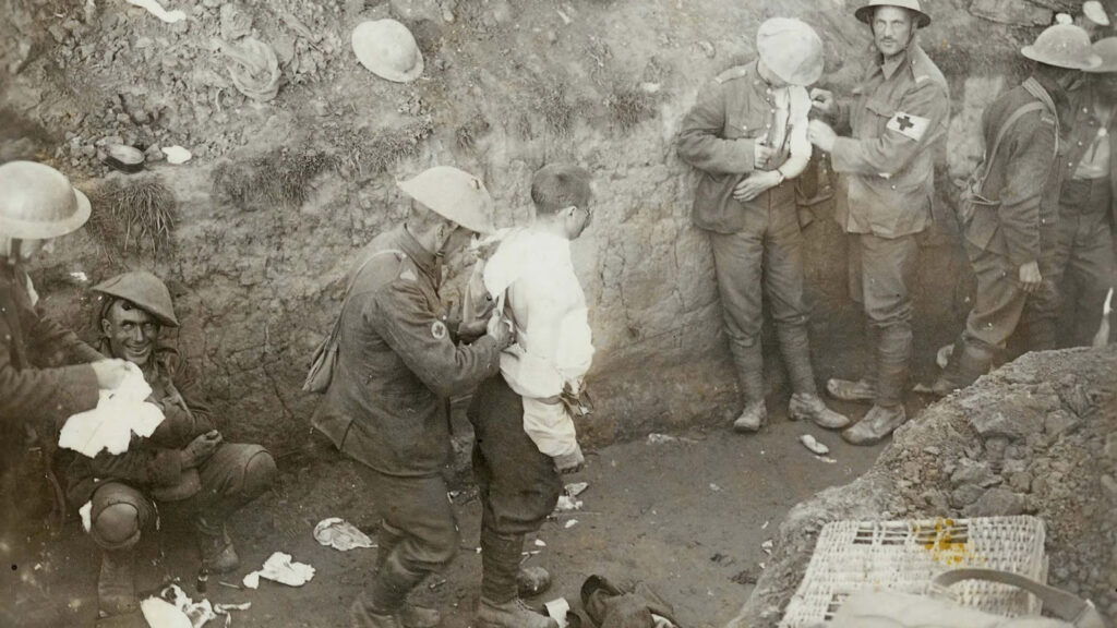 Defining Soldier’s Wounds: U.S. Shell Shock in International ...